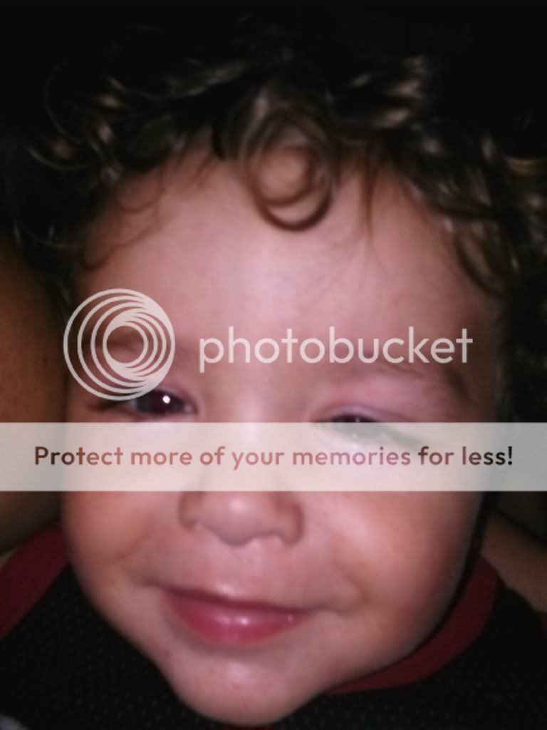 Green beans??? Rash pics | BabyCenter